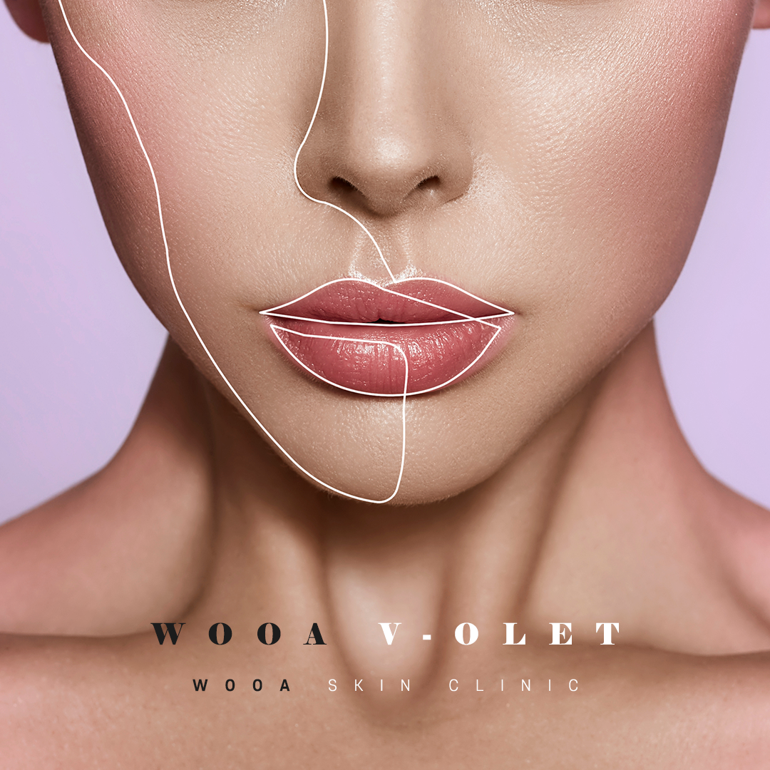 강남 신논현역 우아성형외과 써마지FLX, 인모드, 필러, 보톡스, 리프팅, 울쎄라, 슈링크, 티타늄 리프팅,덴서티